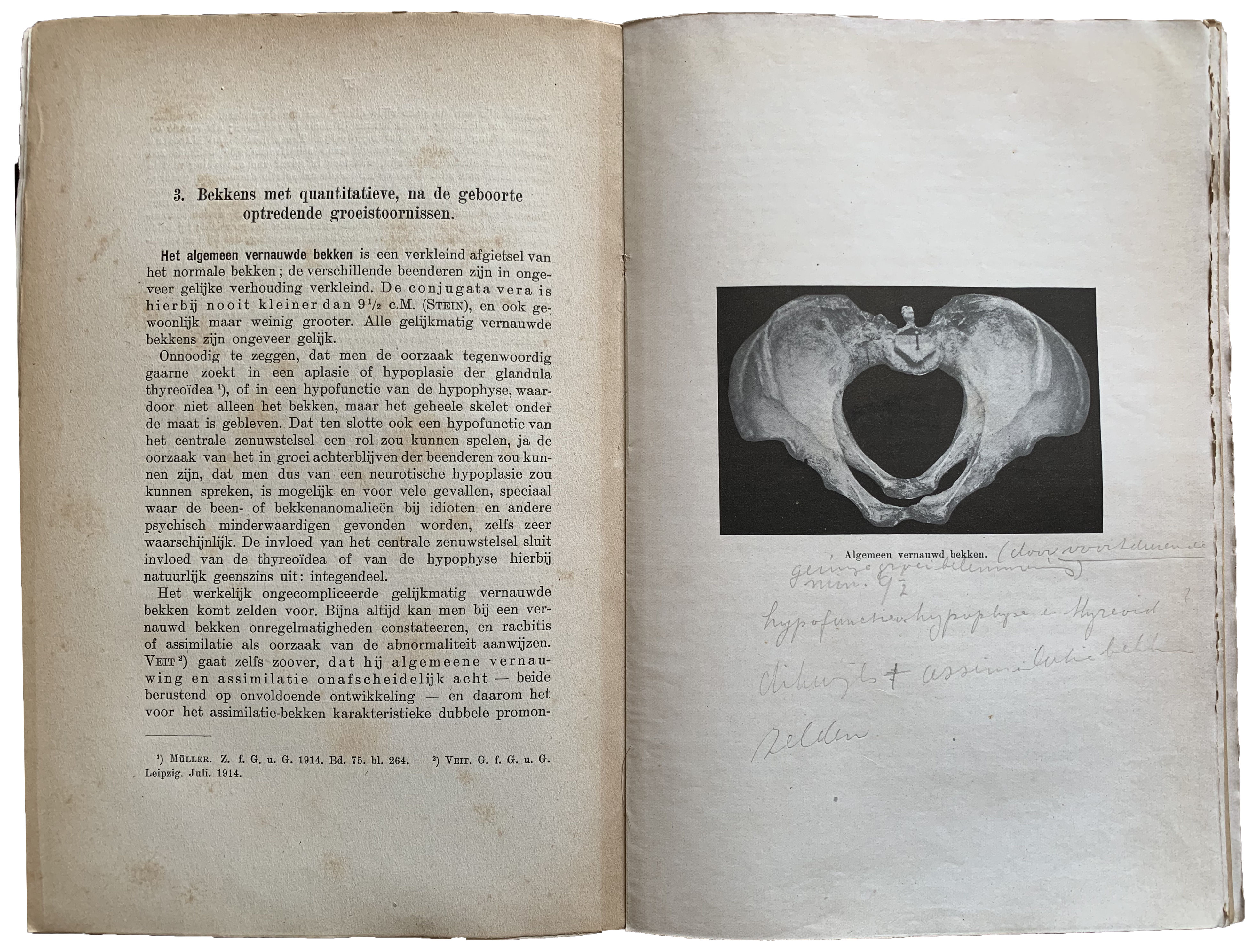 Pathologie van Baring en Puerperium. Met Pathologie van den pasgeborene ...