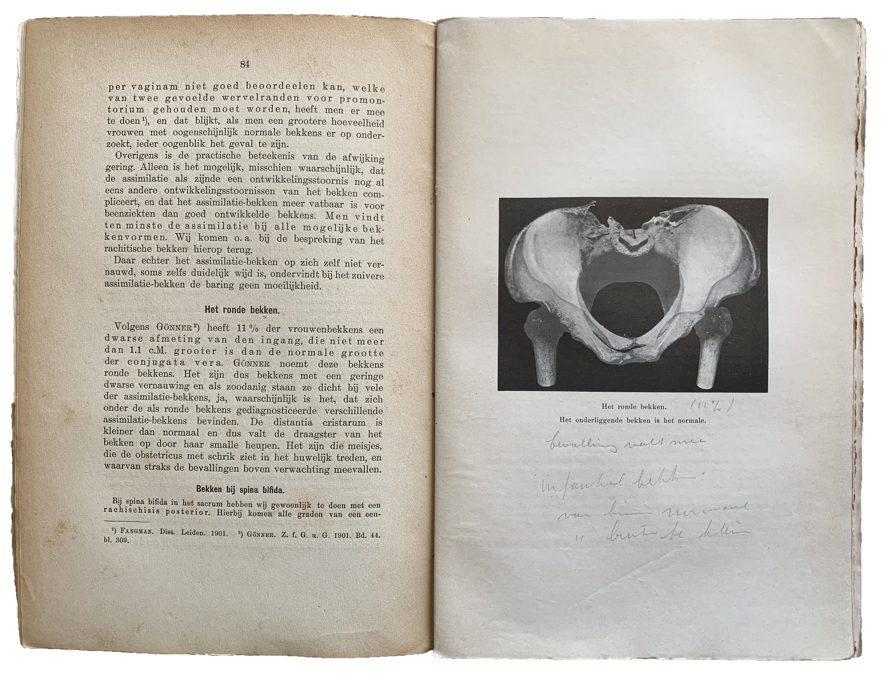 Pathologie van Baring en Puerperium. Met Pathologie van den pasgeborene ...
