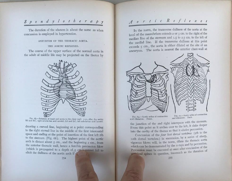 Spondylotherapy: spinal concussion and the application of other methods ...