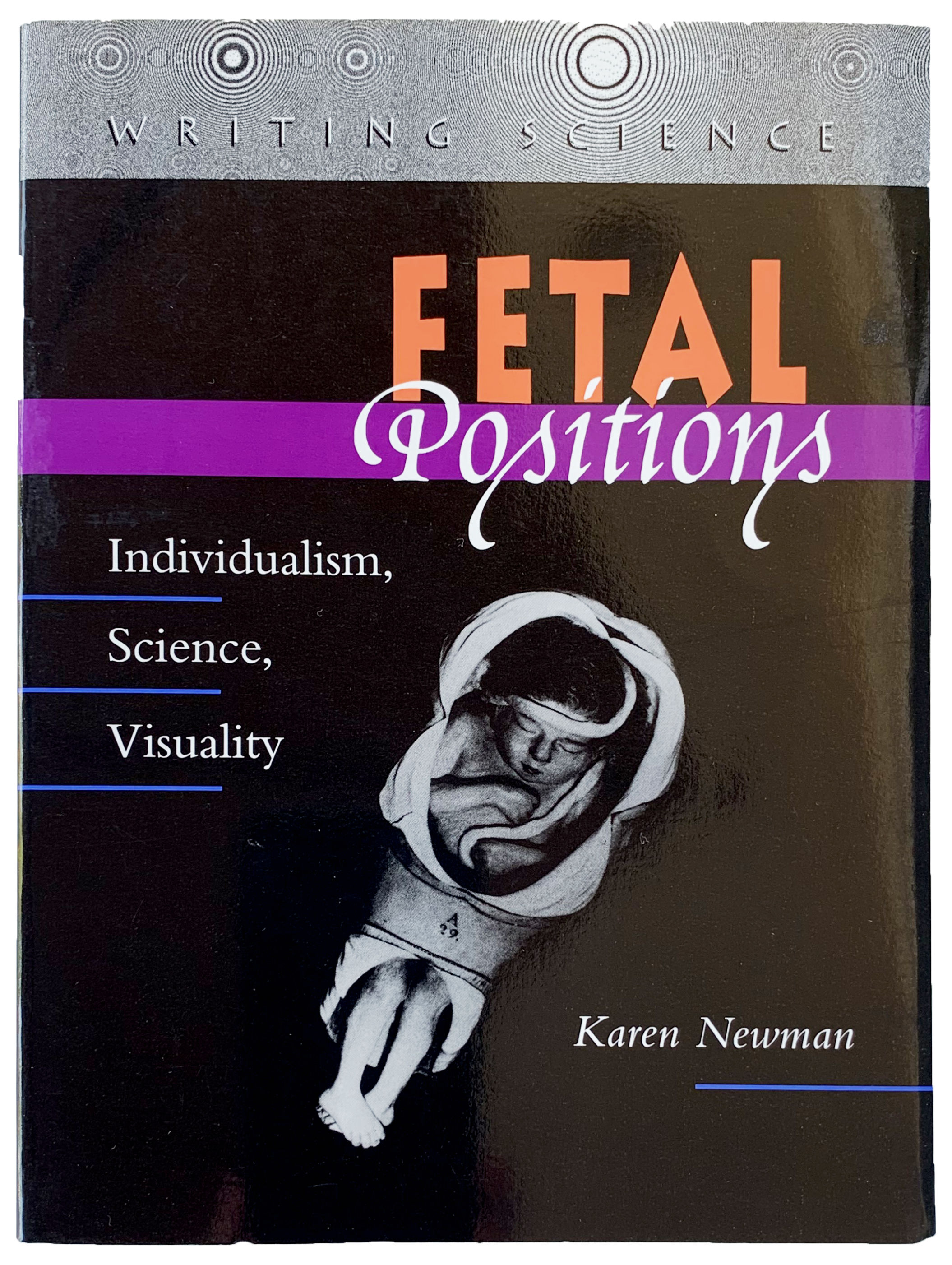 Fetal Positions: Individualism, Science, Visuality.